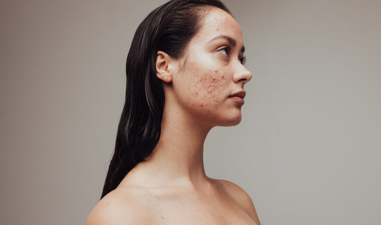 Stress-Related Skin Problems and How to Keep It Clear - Kintsu MedSpa ...